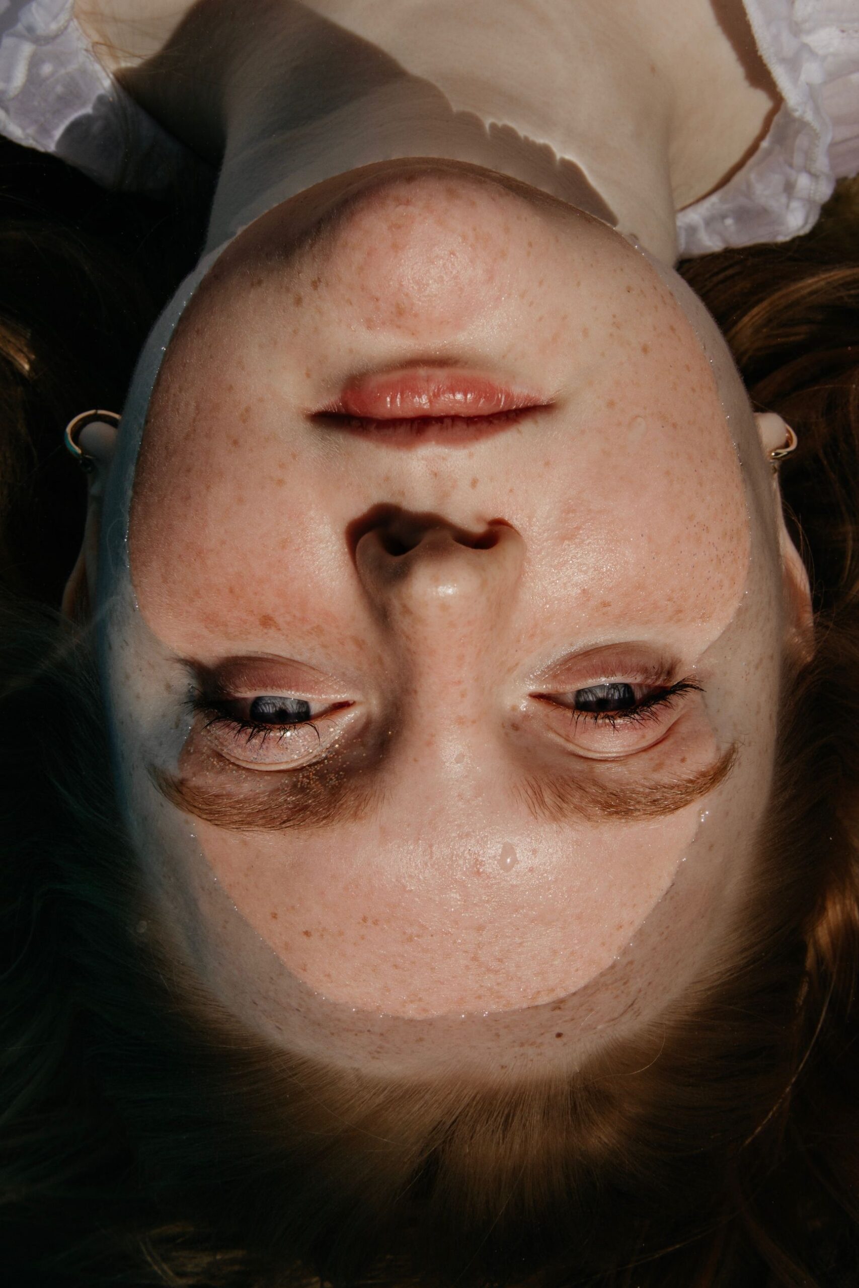 What percentage of people have freckles? – My Web Stats